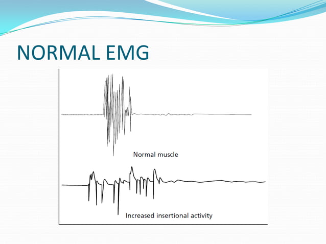 Electrodiagnosis 1 | PPTX