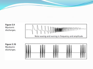 Electrodiagnosis 1 | PPTX