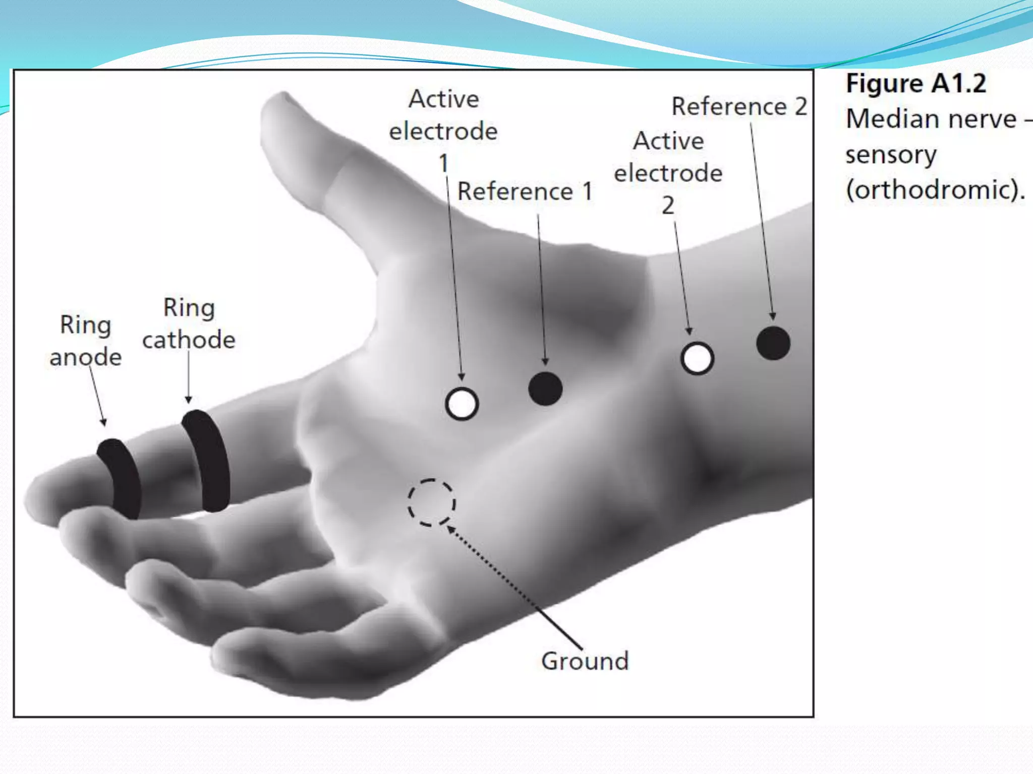 Electrodiagnosis practice | PPTX