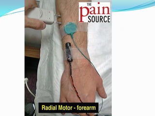 Electrodiagnosis practice | PPT