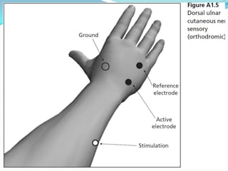 Electrodiagnosis practice | PPT