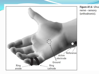 Electrodiagnosis practice | PPT