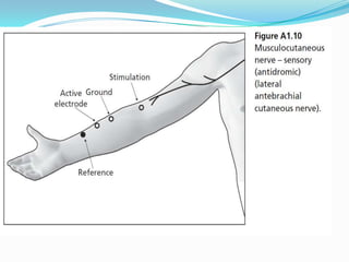Electrodiagnosis practice | PPT