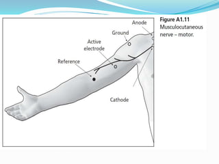 Electrodiagnosis practice | PPT
