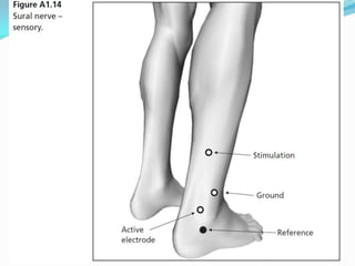 Electrodiagnosis practice | PPT