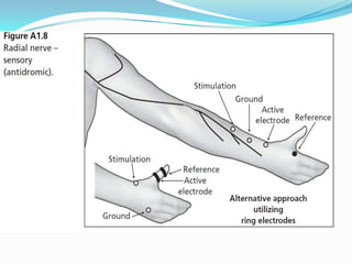 Electrodiagnosis practice | PPT