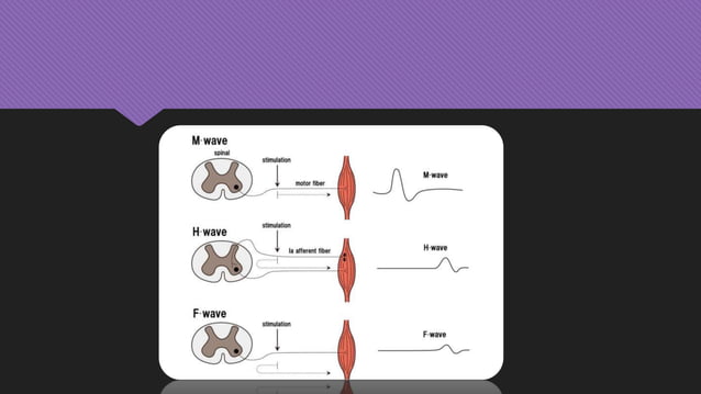 Electrodiagnostic I | PPTX | Brain and Nervous System Disorders ...