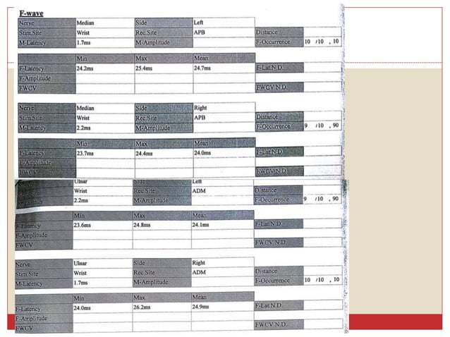 Electrodiagnostic approach to peripheral neuropathy | PPTX | Brain and ...