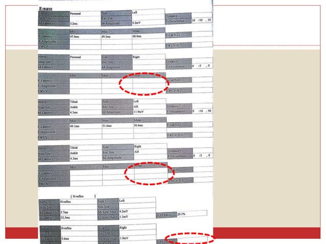 Electrodiagnostic approach to peripheral neuropathy | PPTX | Brain and ...