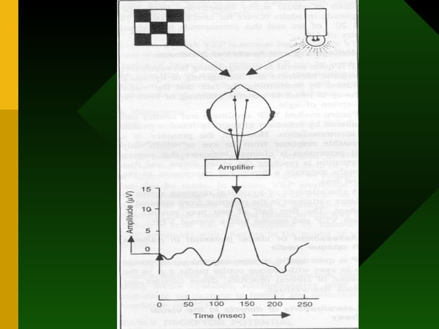 Electrodiagnostic Tests in Ophthalmology | PPT | Eye and Vision ...