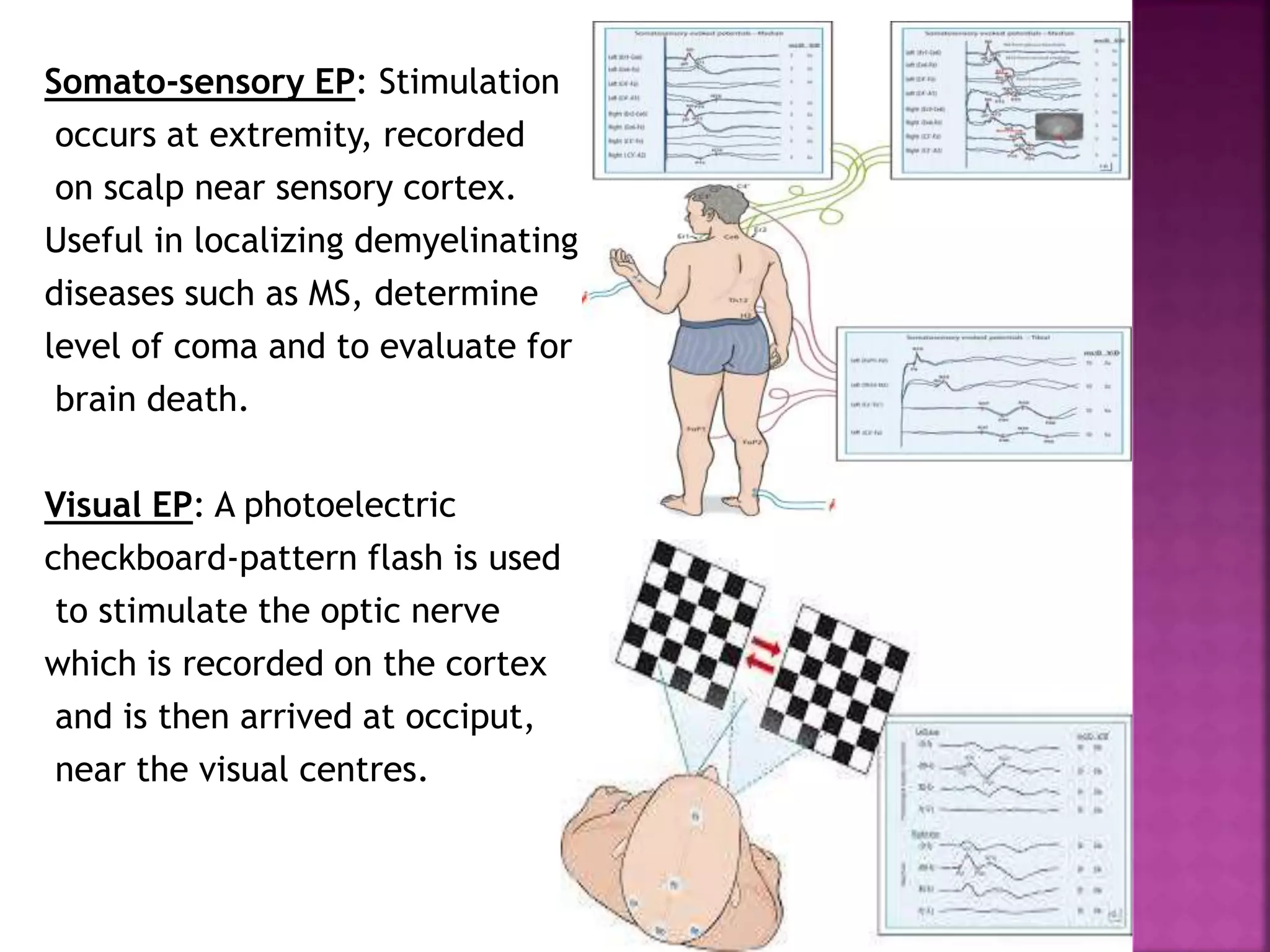 Electro diagnostic tests ppt | PPTX