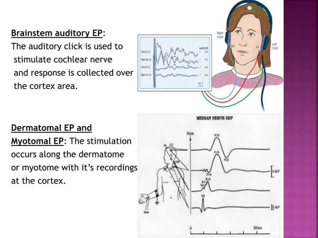 Electro diagnostic tests ppt | PPTX