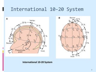 Electroencephalogram(EEG) | PPTX