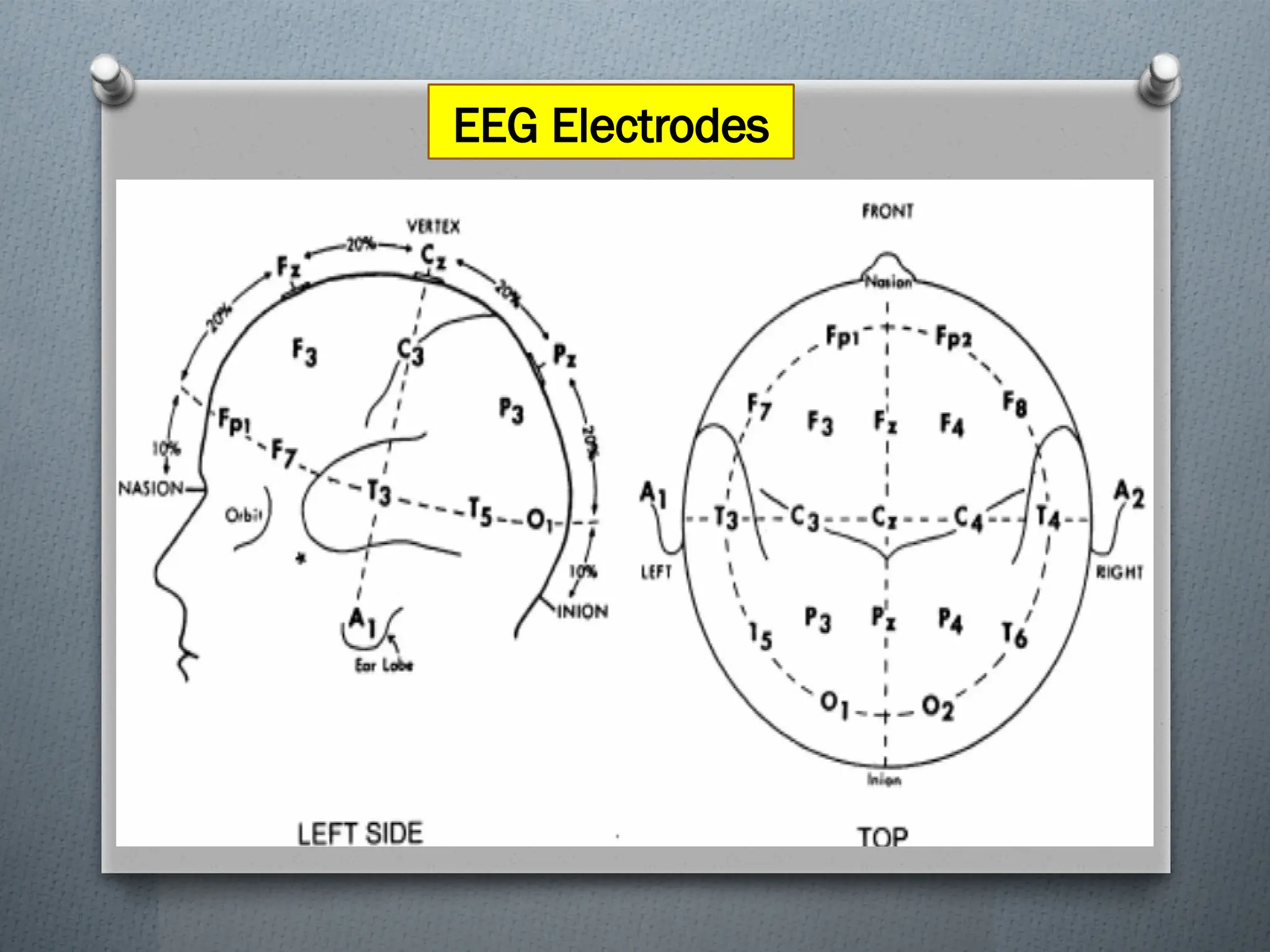 electroencephalogram bio signal analysis ecg | PPTX