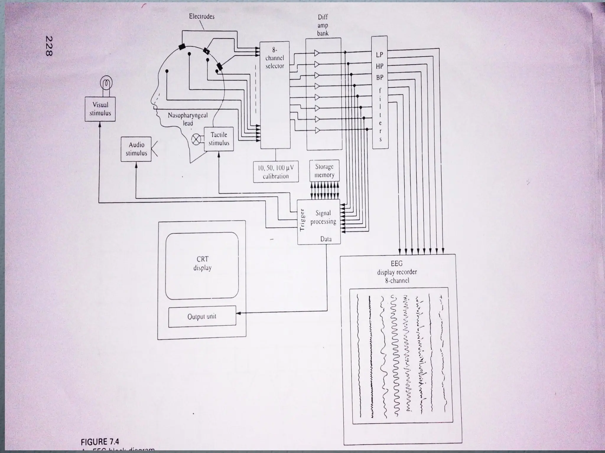 electroencephalogram bio signal analysis ecg | PPTX