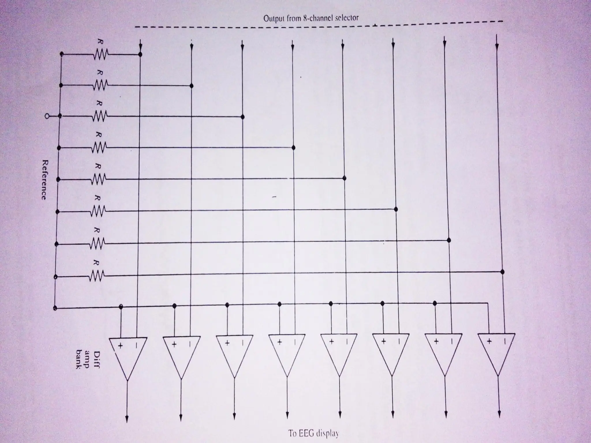 electroencephalogram bio signal analysis ecg | PPTX