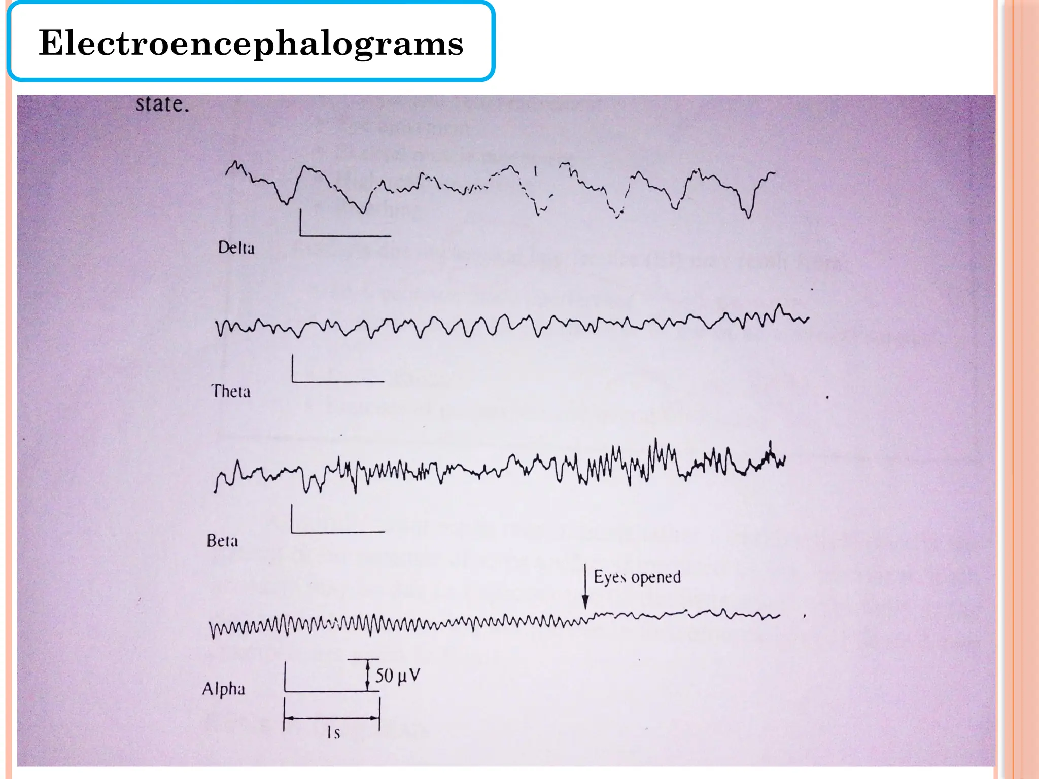 electroencephalogram bio signal analysis ecg | PPTX
