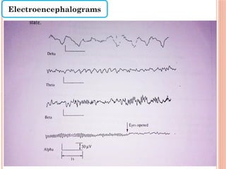 electroencephalogram bio signal analysis ecg | PPTX