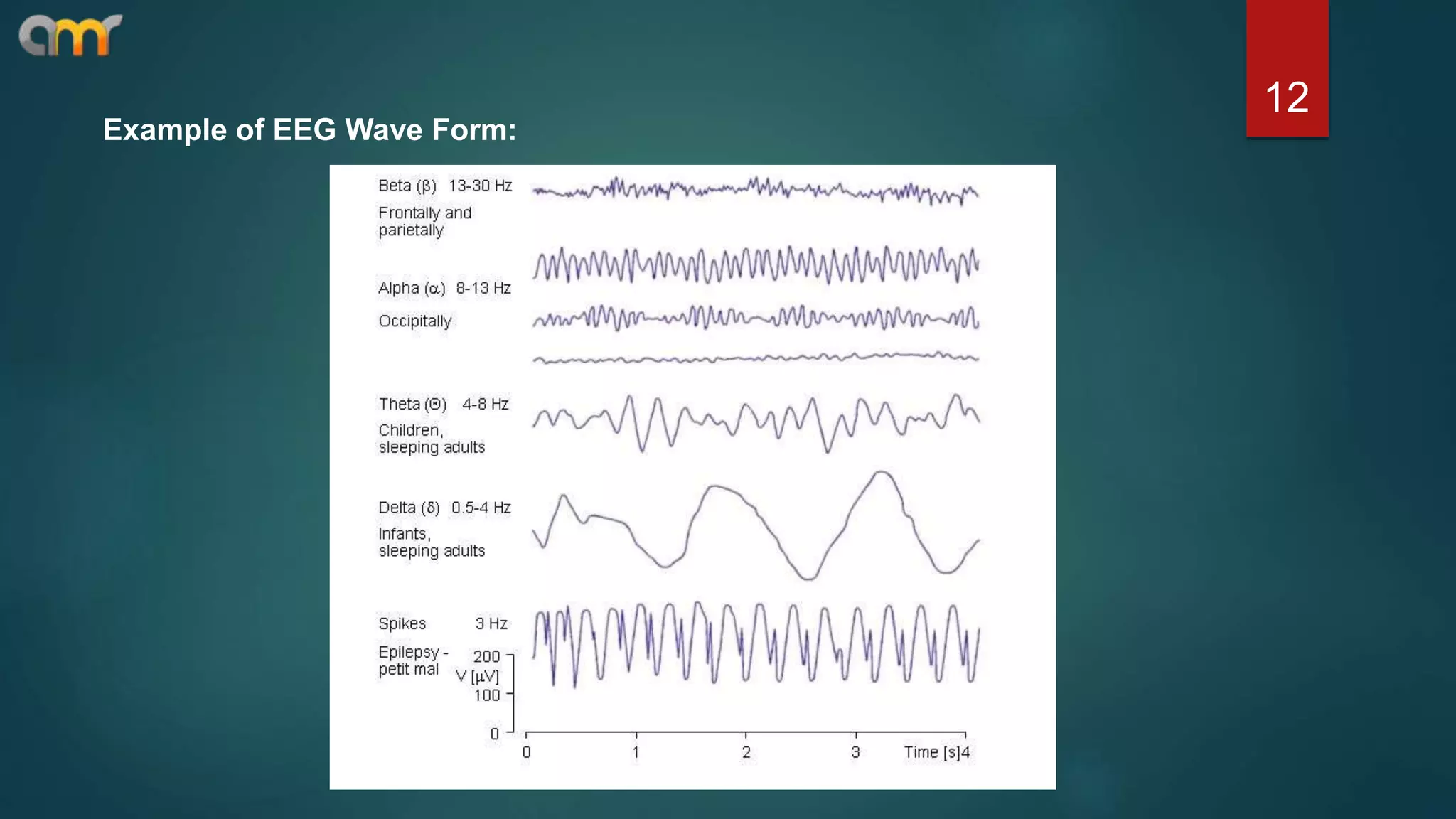 Electroencephalography (EEG) | PPTX