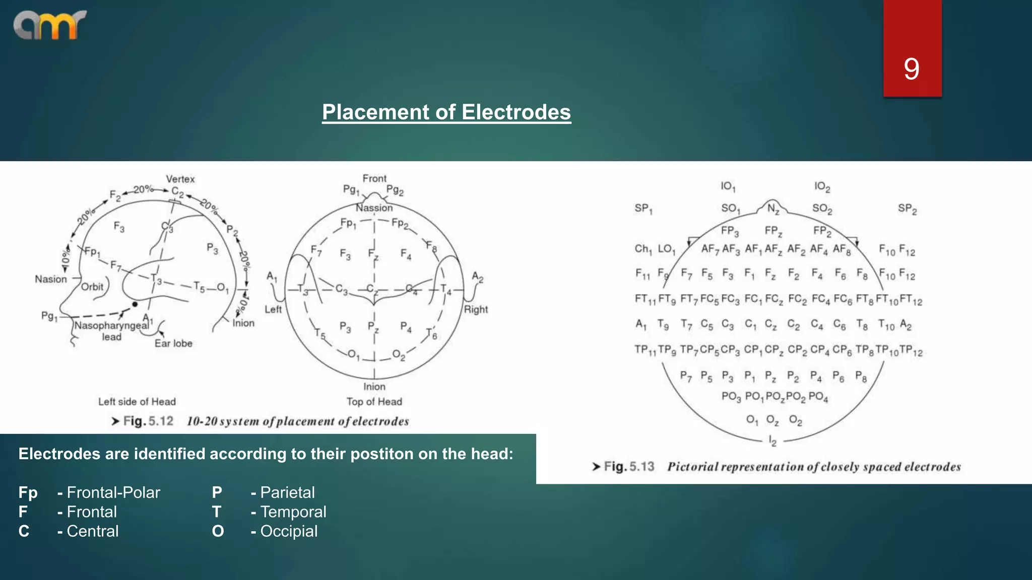 Electroencephalography (EEG) | PPTX