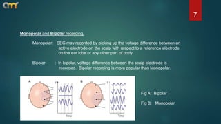 Electroencephalography (EEG) | PPTX