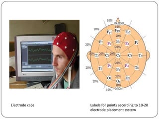Electroencephalography | PPTX