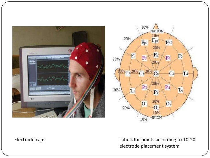 Electroencephalography