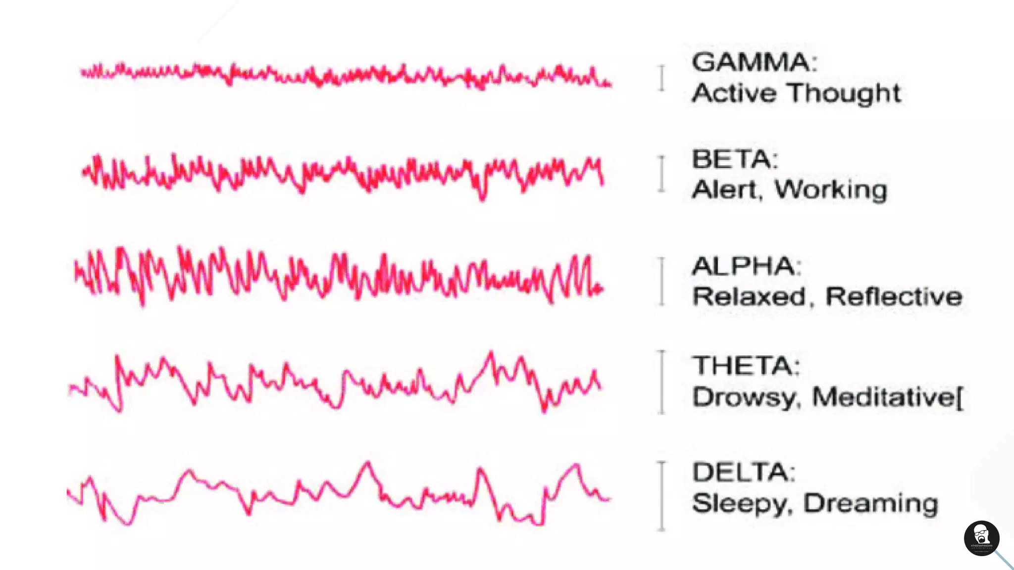 Electroencephalography (EEG) - Basics | PDF