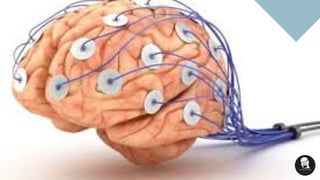 Electroencephalography (EEG) - Basics | PDF