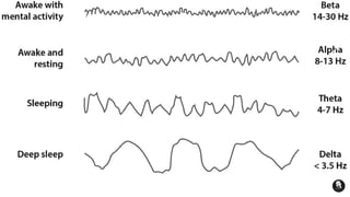 Electroencephalography (EEG) - Basics | PDF