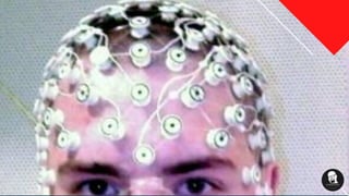 Electroencephalography (EEG) - Basics | PDF