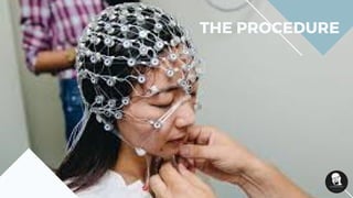 Electroencephalography (EEG) - Basics | PDF