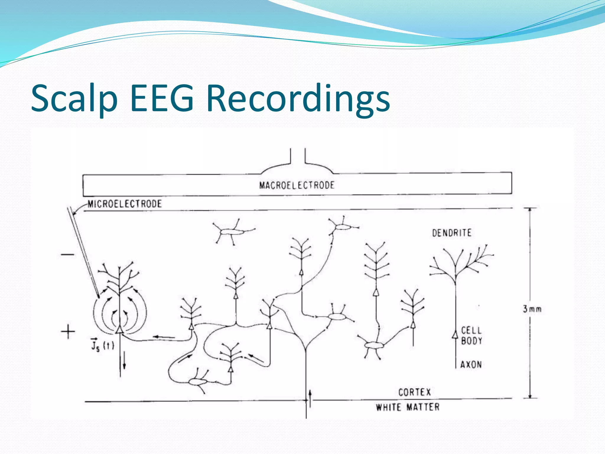 Electroencephalography (eeg) | PPTX