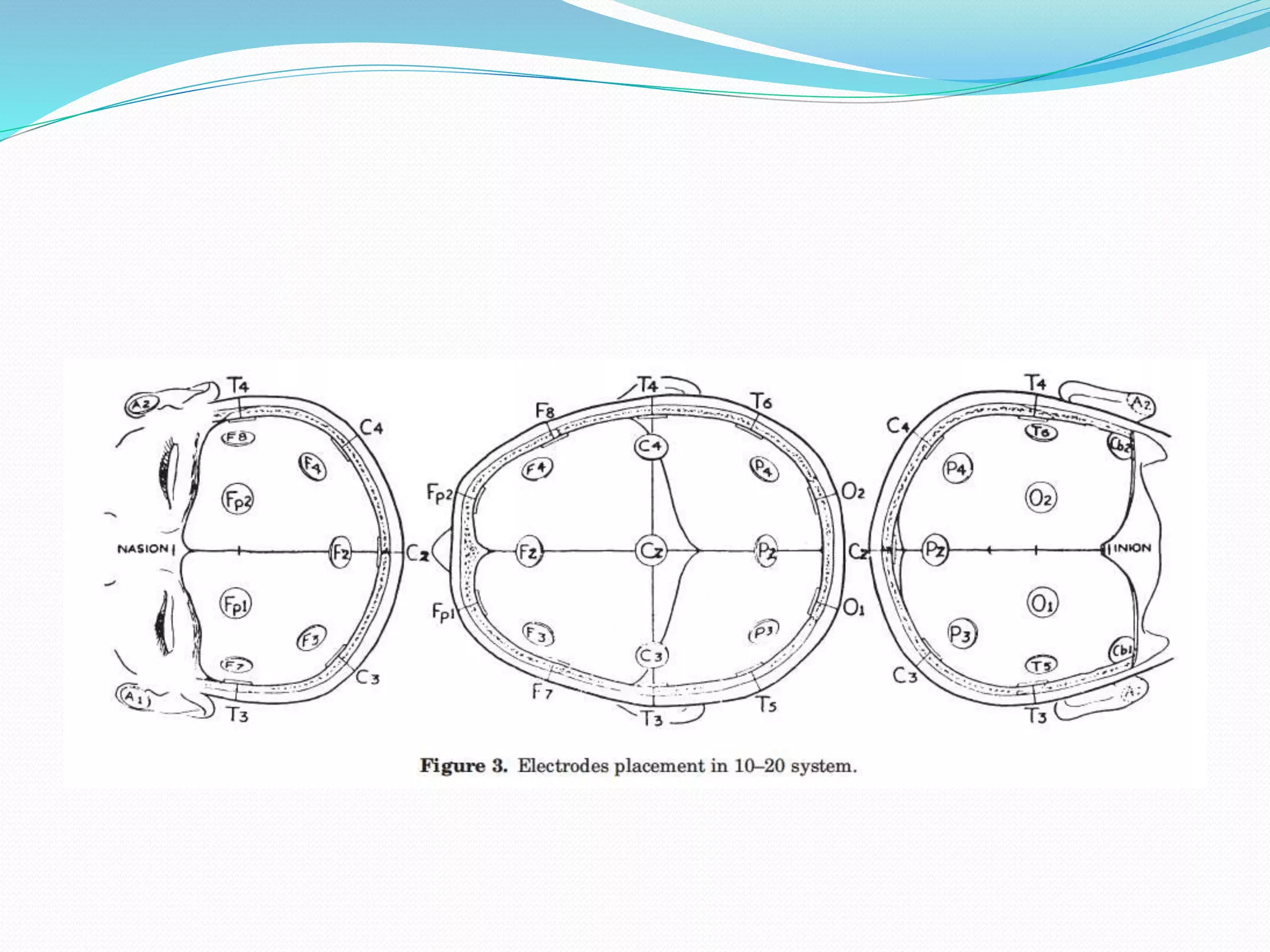 Electroencephalography Eeg Pptx