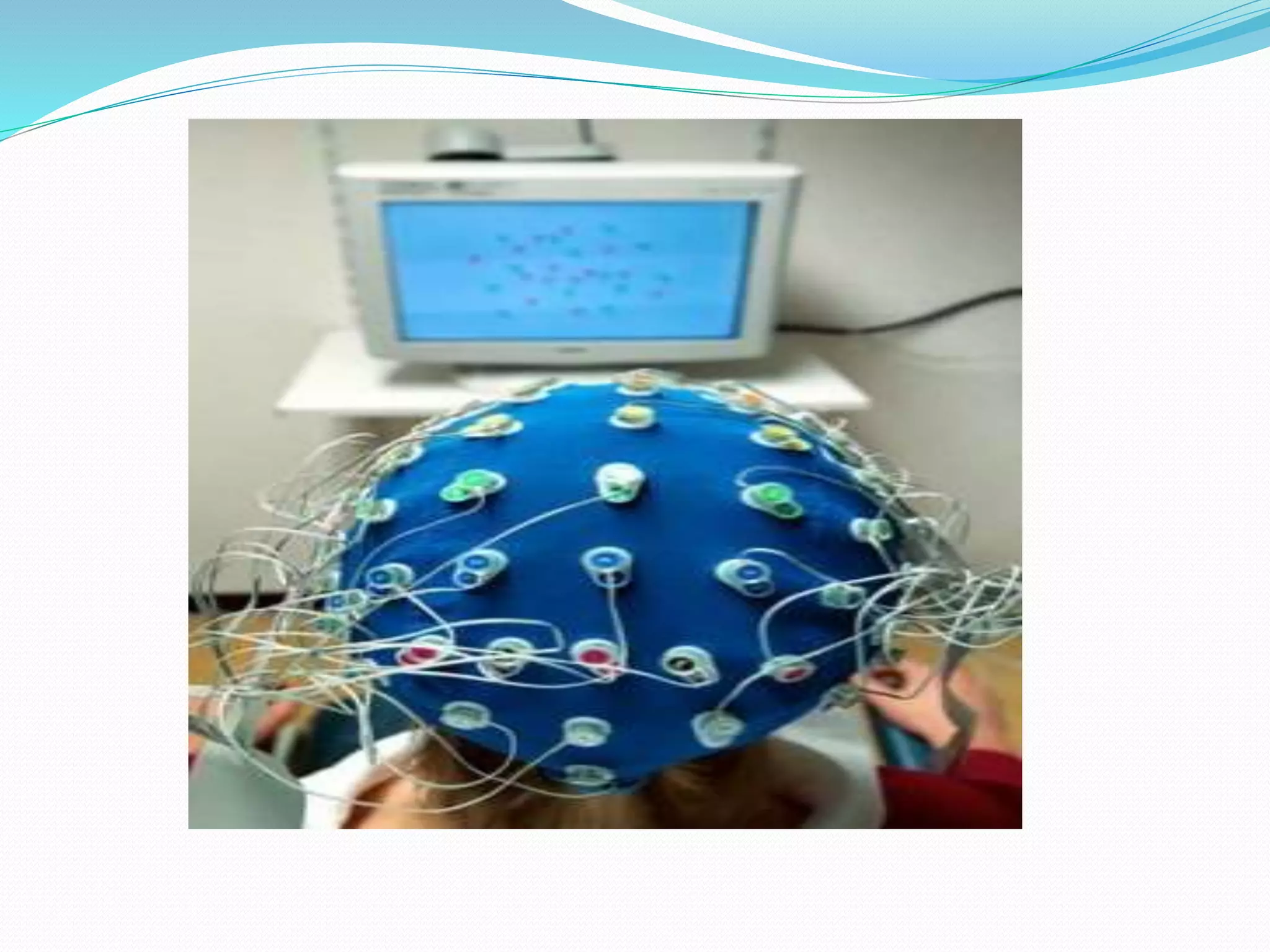 Electroencephalography (eeg) | PPTX