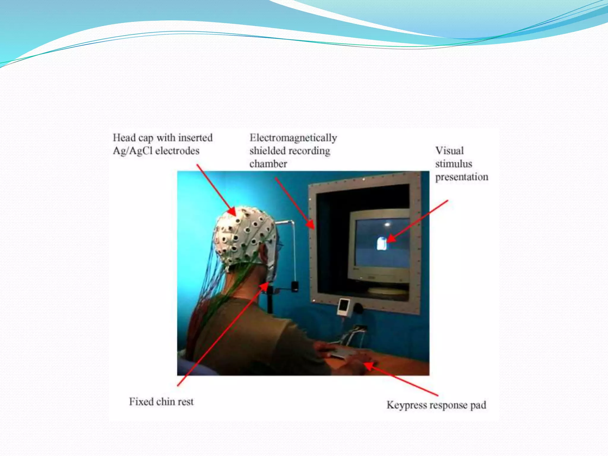 Electroencephalography (eeg) | PPTX