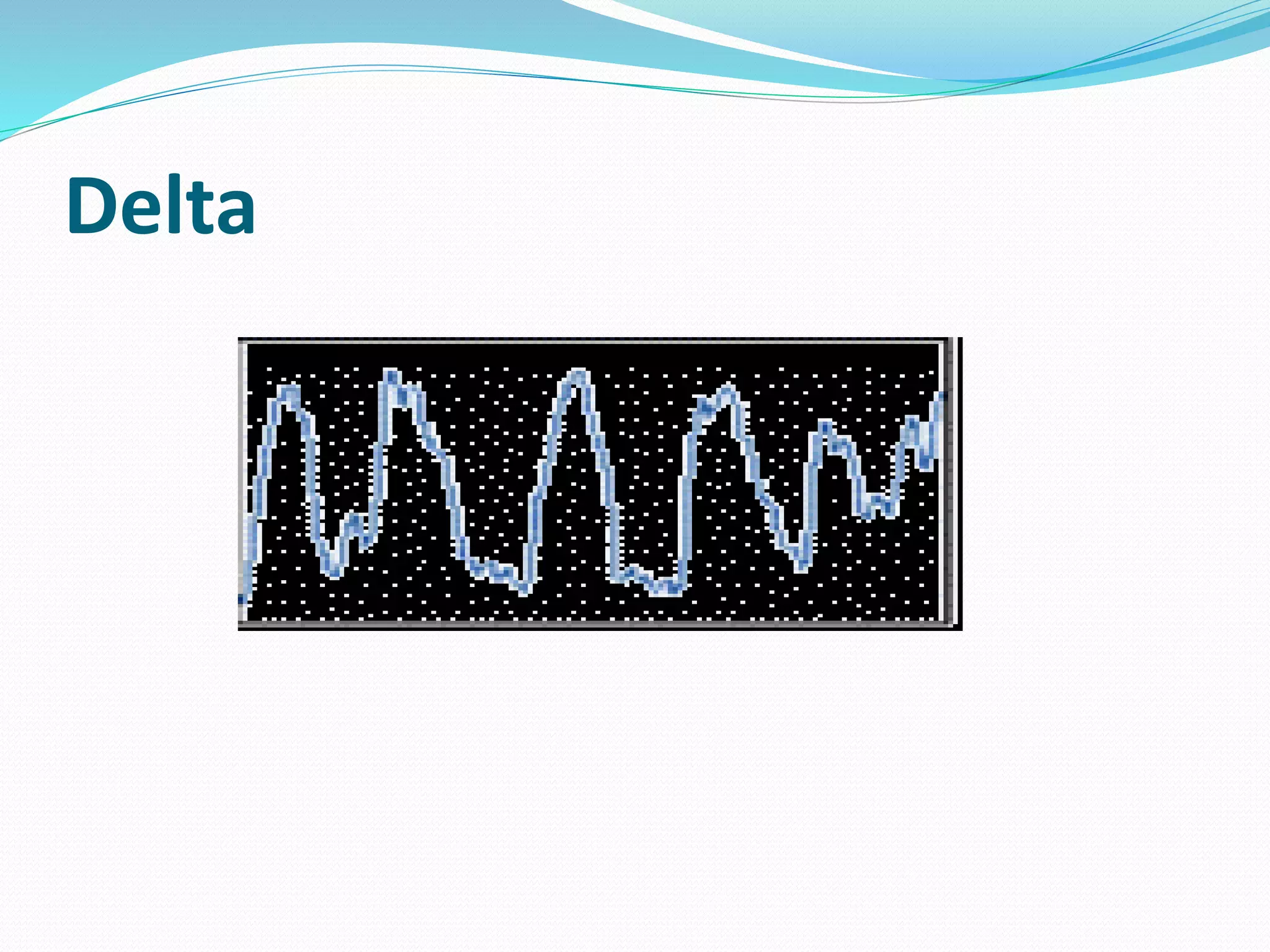 Electroencephalography (eeg) | PPTX