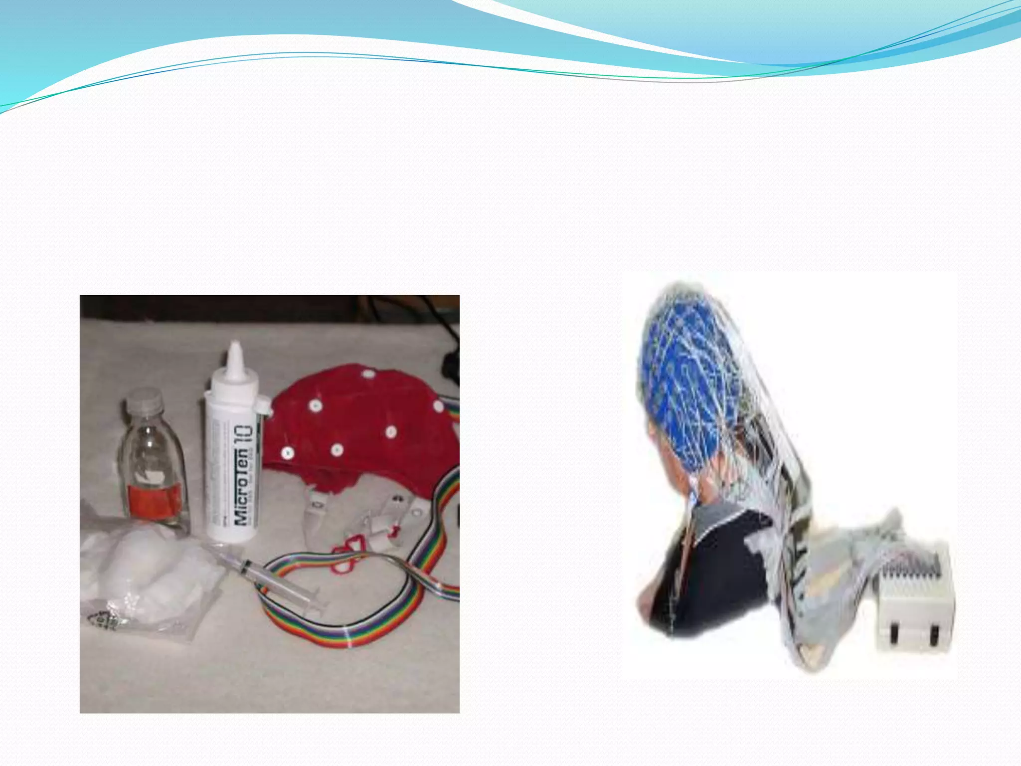 Electroencephalography (eeg) | PPTX