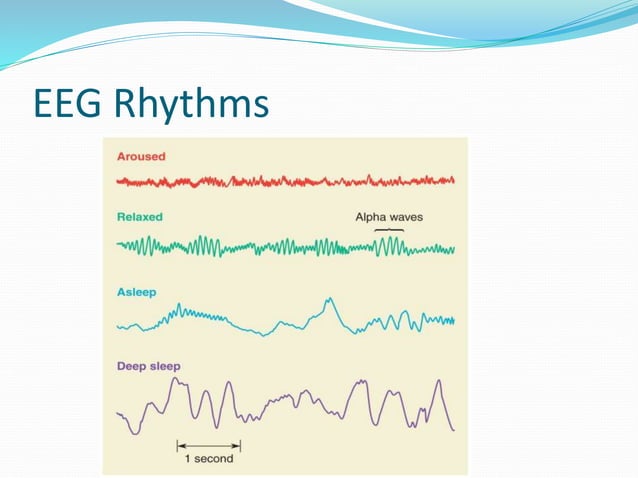 Electroencephalography (eeg) | PPTX