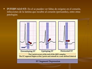 Electrocardio - Fisio | PPT