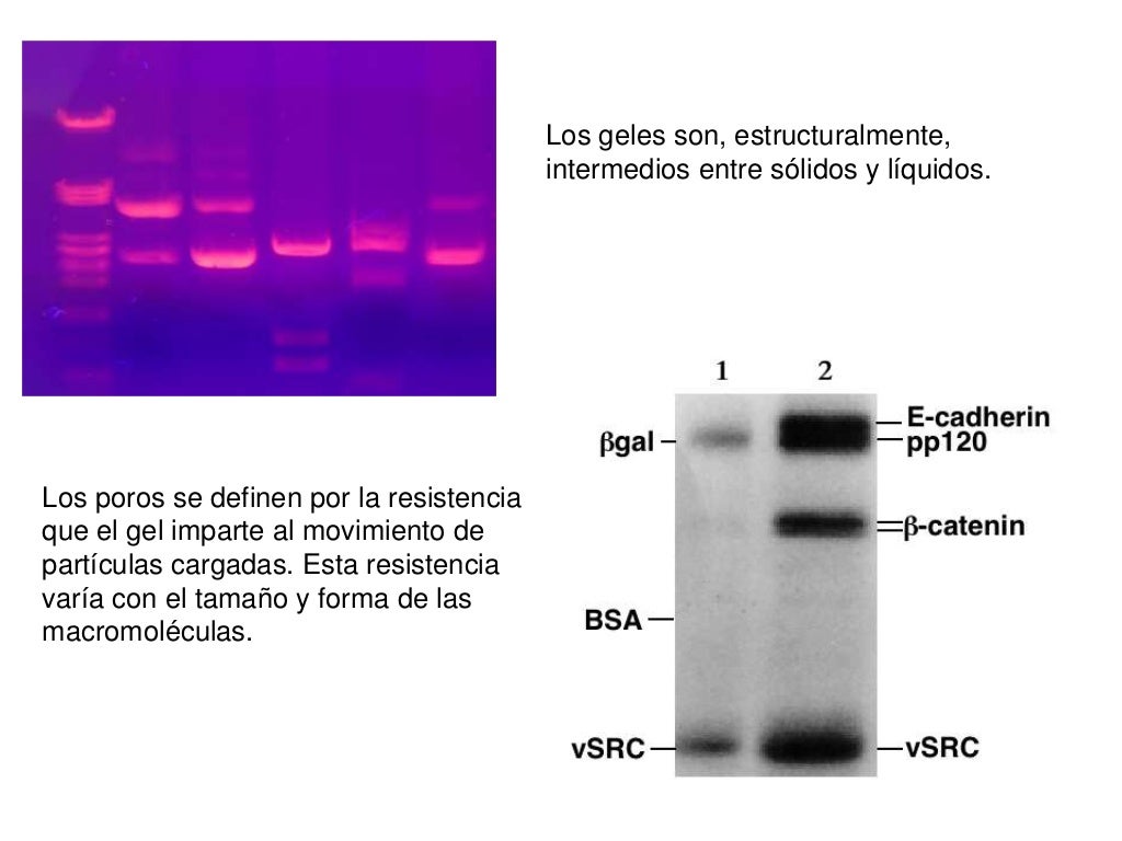 Electroforesis de ADN
