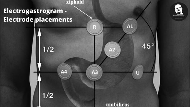 Electrogastrogram basics | PDF | Digestive Disorders | Diseases and ...