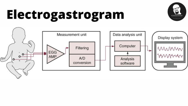 Electrogastrogram basics | PDF | Digestive Disorders | Diseases and ...