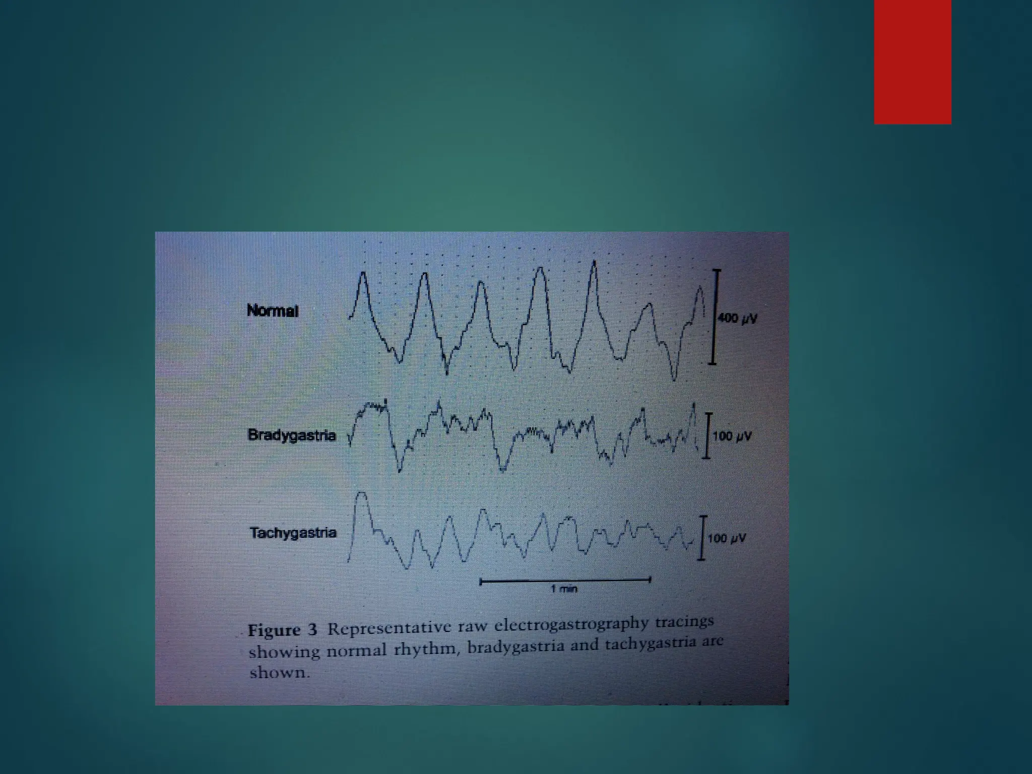 Brief Introduction on Electro gastrography-SSM.ppt