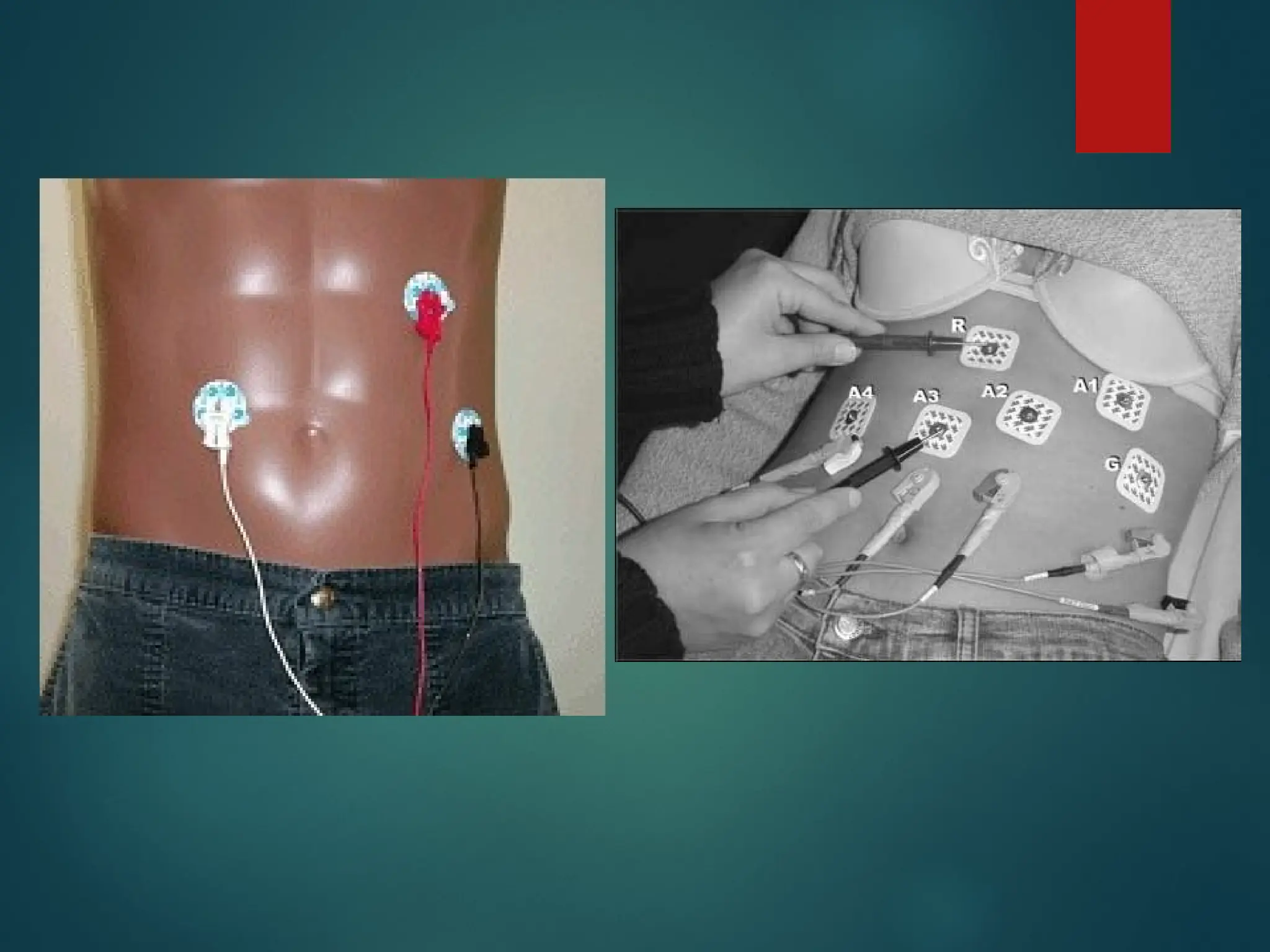 Brief Introduction on Electro gastrography-SSM.ppt