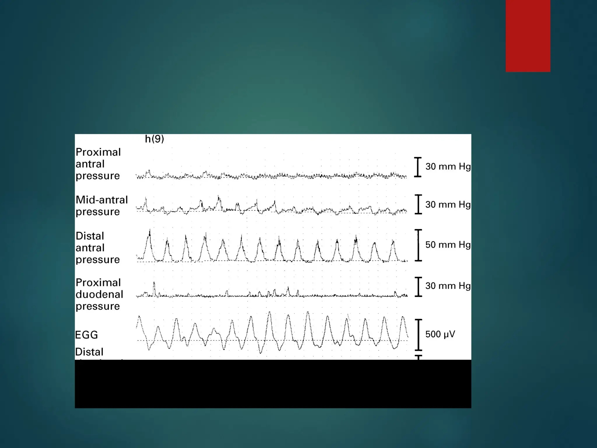Brief Introduction on Electro gastrography-SSM.ppt