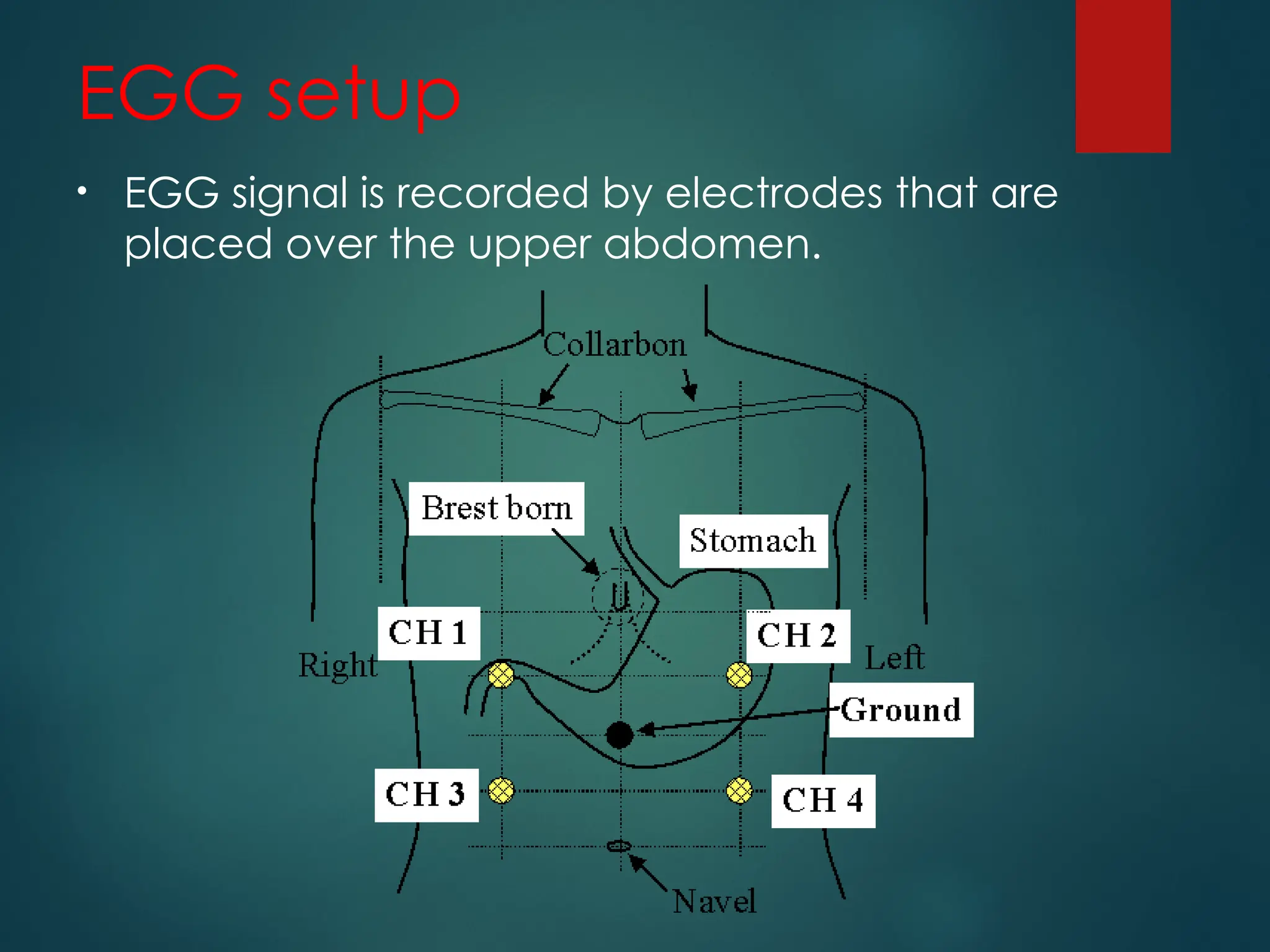 Brief Introduction on Electro gastrography-SSM.ppt