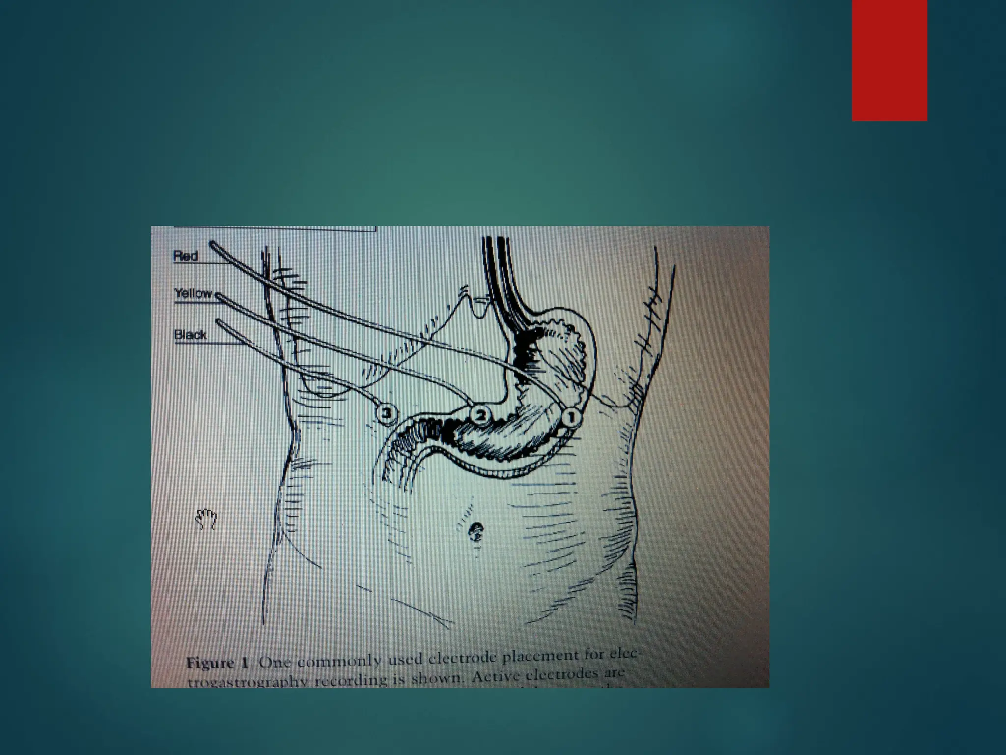 Brief Introduction on Electro gastrography-SSM.ppt