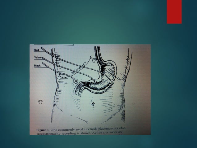 Brief Introduction on Electro gastrography-SSM.ppt