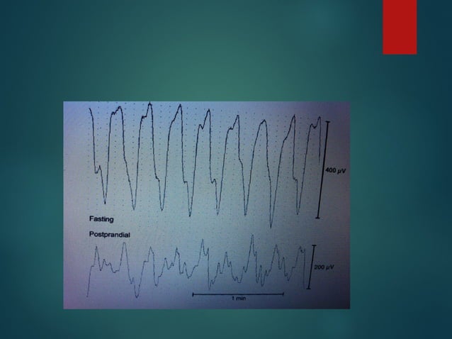 Brief Introduction on Electro gastrography-SSM.ppt